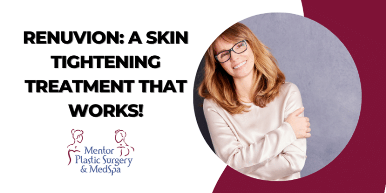 Renuvion: A Skin Tightening Treatment that Works! - Mentor Plastic Surgery