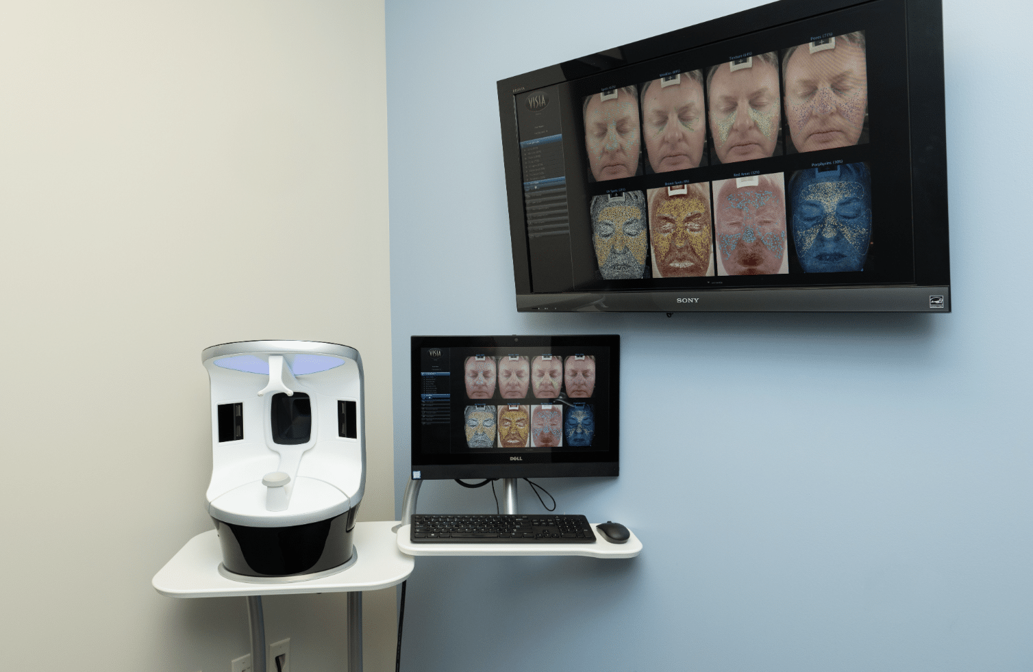 VISIA Complexion Analysis - Mentor Plastic Surgery