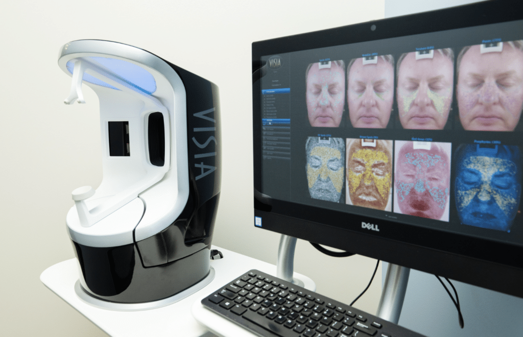 VISIA Complexion Analysis - Mentor Plastic Surgery