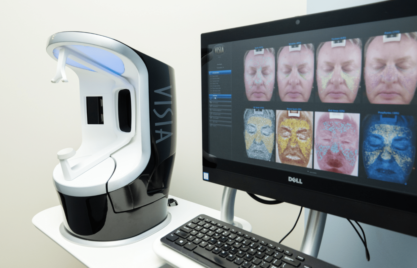 VISIA Complexion Analysis - Mentor Plastic Surgery