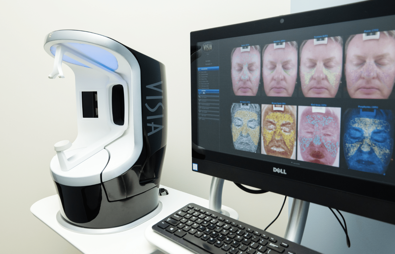 VISIA Complexion Analysis - Mentor Plastic Surgery
